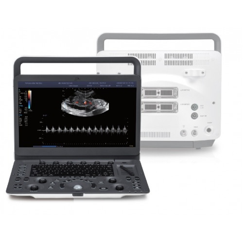 Sonoscape E2 Medical Ultrasound