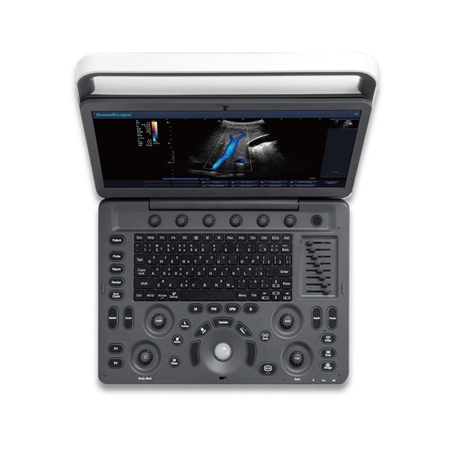 Sonoscape E2 Medical Ultrasound