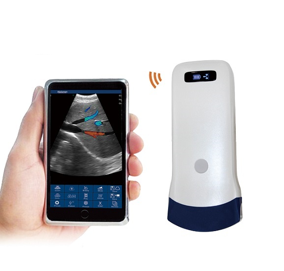 128 elements Color doppler single head convex probe