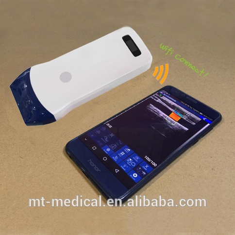 128 elements Color doppler linear wireless ultrasound