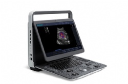 Sonoscape E2 Medical Ultrasound
